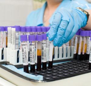 Dog Blood Tests Explained - Animal Behavior College